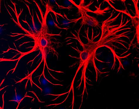 Anti Glial Fibrillary Acidic Protein Gfap Antibody 5c10 Gfap