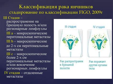 Опухоли и опухолевидные образования яичников Рак яичников