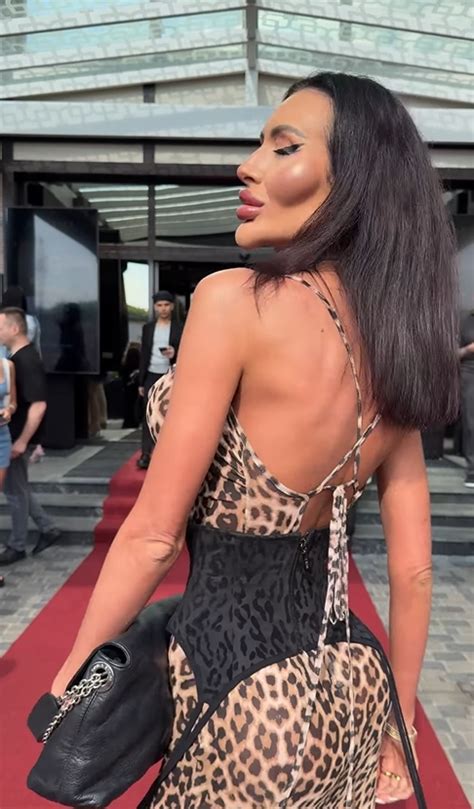 Žena S Obřími Lícními Kostmi Si Nechala Udělat Lifting Pozadí A Její