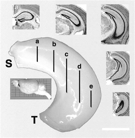 Hippocampus Anatomy Mouse