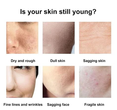 Retinol Anti Aging Wrinkle Removal Skin Firming Cream