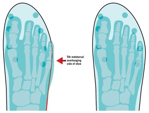 Aspetar Sports Medicine Journal HEY COACH DOCTOR PHYSIO PODIATRIST DAD MUM WHAT FOOTBALL