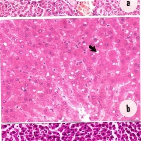 A Section In Liver Of A Control Rat Showing Central Vein