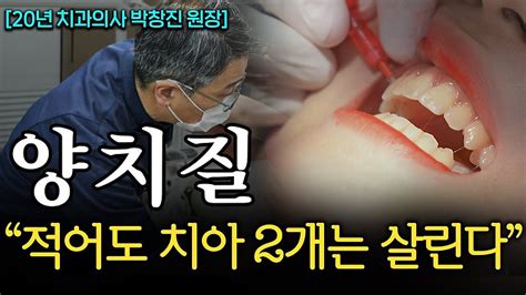 치석 싹 녹아내린다 평생 치과에 돈 안 써도 되는 최고의 양치질 방법 박창진 원장