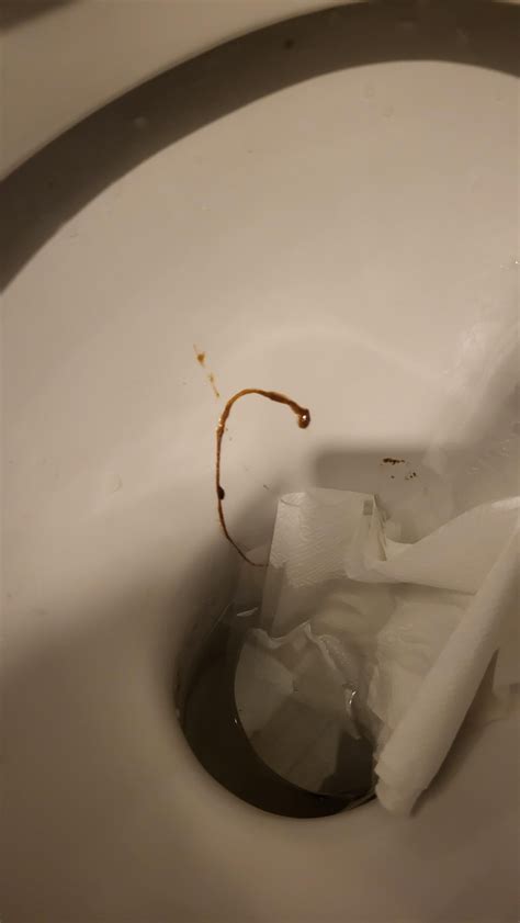 Please Are These Worms In Stool 🤢🤮😭 Rdiagnoseme