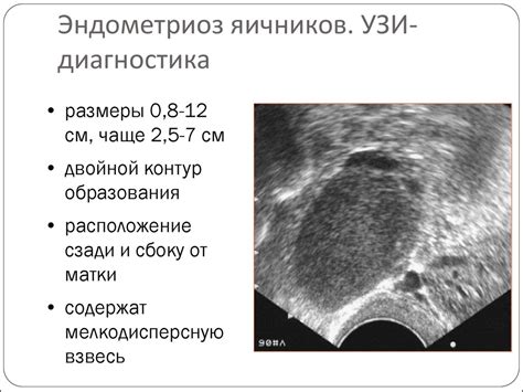 Наружный генитальный эндометриоз Классификация Этиопатогенез