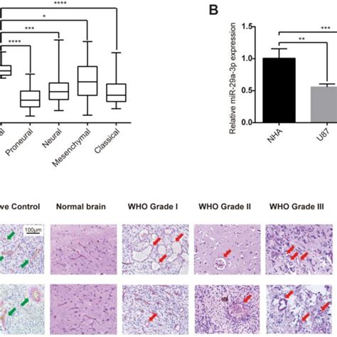 Glioma Formed Vm Structures And Showed Aberrantly Low Expression Level