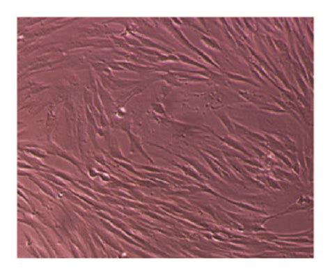 Morphology Of Human Periodontal Ligament Fibroblast Hpdlfs A