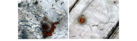 Montage Of Photomicrographs 1009 Of Spore Cyst Attached To The Download Scientific Diagram