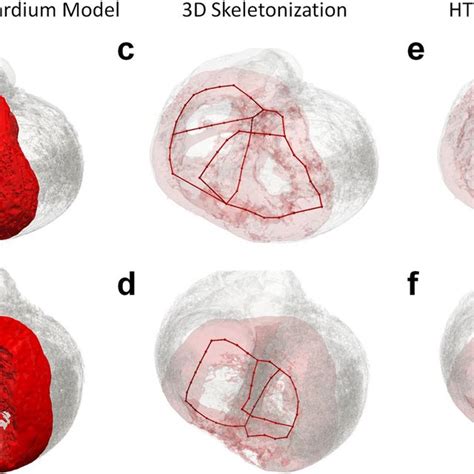 Example Of 3d Structural Viable Myocardium Models 3d Skeletons And Download Scientific