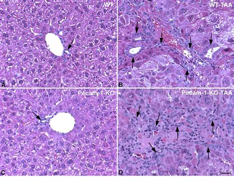 Figure 1 From Development Of A New Mouse Model For Intrahepatic