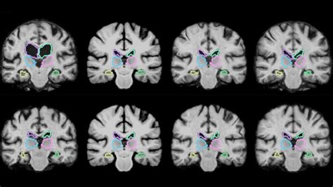 Mit Deep Learning Algorithm Finds Hidden Warning Signals In Measurements Collected Over Time
