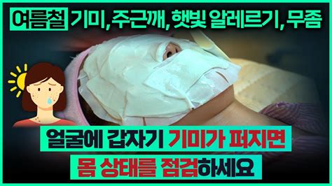 피부여름철 기미 주근깨 햇빛 알레르기 무좀피부가 흰 분들 자외선 차단 더 해야 합니다얼굴 피부빛이 검어지면 간 신장을 조심하세요부산mbc 190610 방송