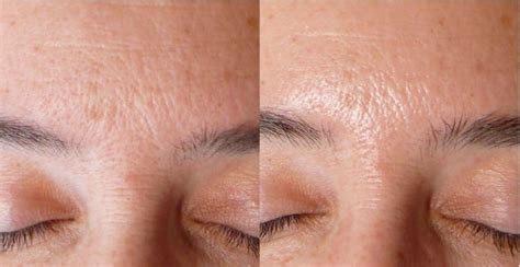 How To Repair Dead Skin Cells On Face Skin Care And Beauty Products