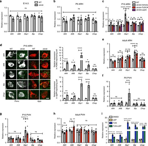Leptin Deficiency Increases Endoplasmic Reticulum Stress Markers In The