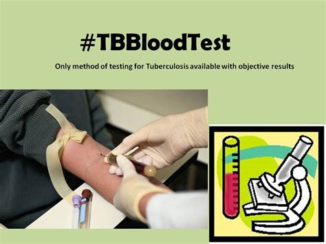 A New Way To Test For Tuberculosis TBBloodTest My Life Is A Journey Not A Destination