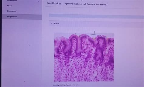 Solved Course Tools Pal Histology Digestive System Lab Chegg