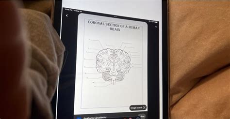 Coronal Section Of A Human Brain Chegg