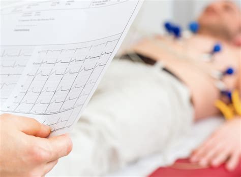 Understanding The Electrocardiogram From Basics To Practice