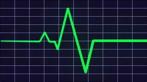 Heartbeat Monitor Machine