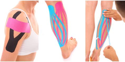 Vendaje funcional beneficios en Fisioterapia Deportiva MOV Rehabilitación