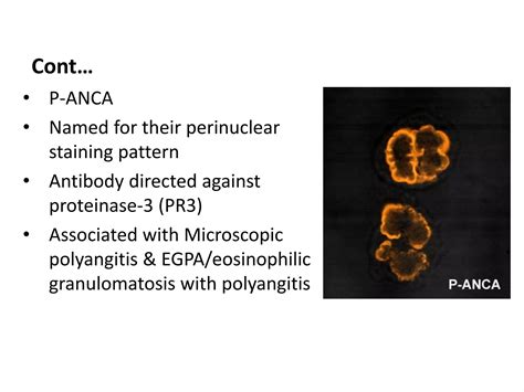 Small Vessel Vasculitis Ppt