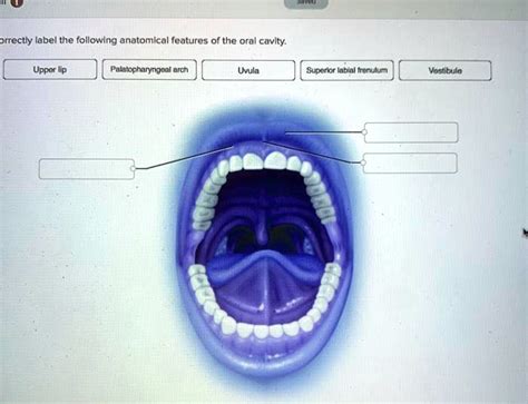 Solved Correctly Label The Following Anatomical Features Of The Oral Cavity Upper Lip
