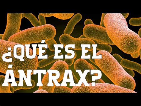 ¿qué Es El ántrax Y Cómo Afecta A Los Niños Me Lo Dijo Lola