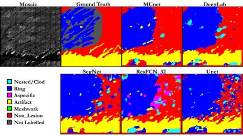 A Multiresolution Convolutional Neural Network With Partial Label