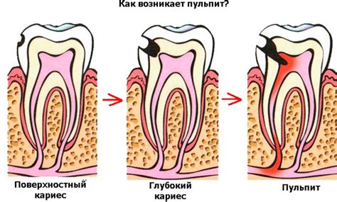 Статьи сообщества Стоматология "АПЕКС" г. Апатиты тел. 656-197 | ВКонтакте