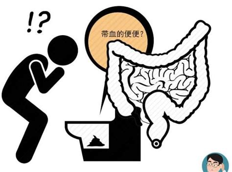 排便时有这5个异常，或是肠癌的征兆，及时检查，别忽视东方养生频道东方养生