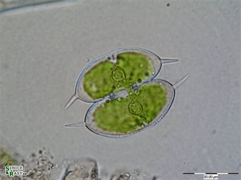Staurodesmus Convergens Galerie