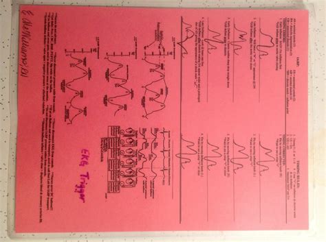 Iabp Waveform Interpretation And Troubleshooting A Comprehensive Guide