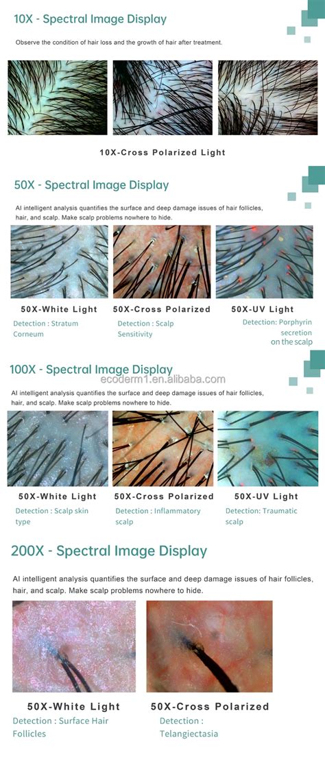 Hair Analysis Scalp Microscope Detector Skin Care Analyzer Scalp