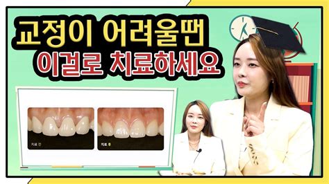자연치와 구분불가 앞니치료 올세라믹 크라운 비포 애프터 🦷🦷 [22세기치리] Youtube