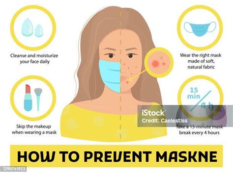 Maskne 팁을 방지하는 방법 코로나바이러스 전염병 동안 보호 얼굴 마스크를 착용하여 발생하는 여드름이나 자극 여성 캐릭터