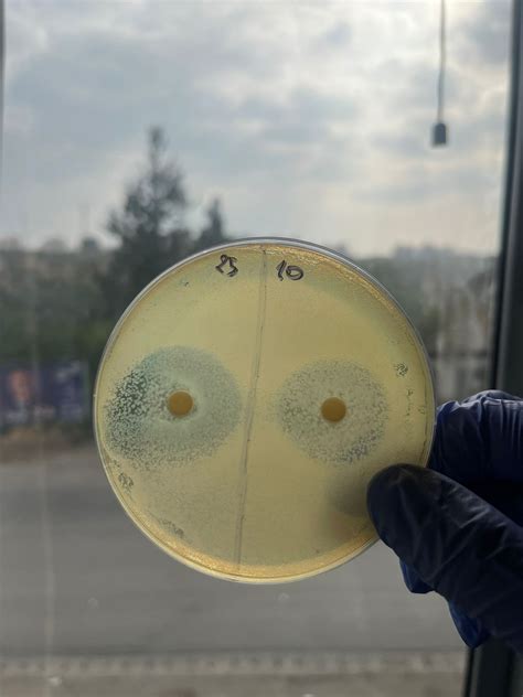 Penicillin Production And Quantification 2023