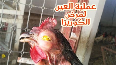 تعلم كيف تؤدي عملية العين لمرض الكوريزا الجزء الاول Youtube