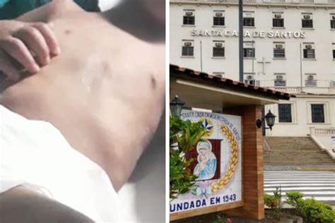 Menino Que Foi Espancado Pela Mãe E Padrasto Recebe Alta Santa Portal