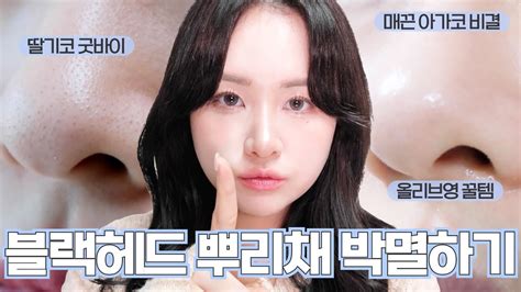 피부과 블랙헤드 한번에 100 없애는 법🩵 모공관리 블랙헤드 관리 피지 없애는 법 피지연화제 추천•피부 좋아지는 법