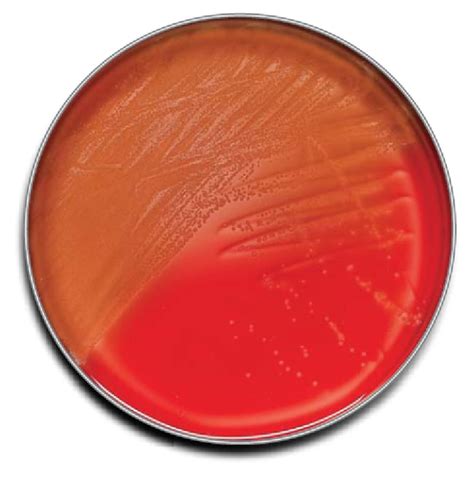 BD BBL Prepared Plated Media V Agar Pk Buy Online BD Fisher Scientific