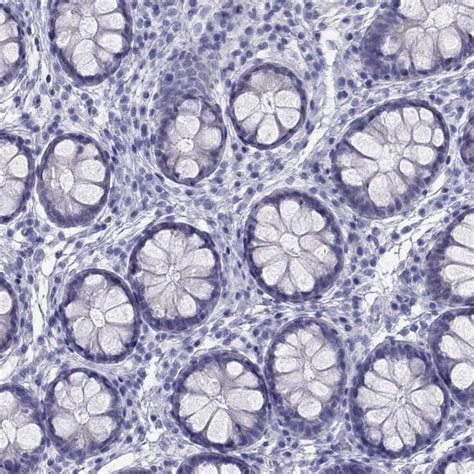 Trpm3 Antibody Pa5 139988