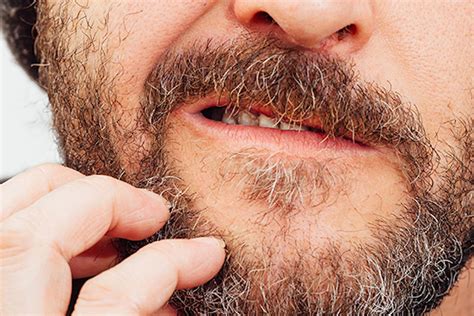 Why Does My Beard Itch Causes And Solutions Derm Dude