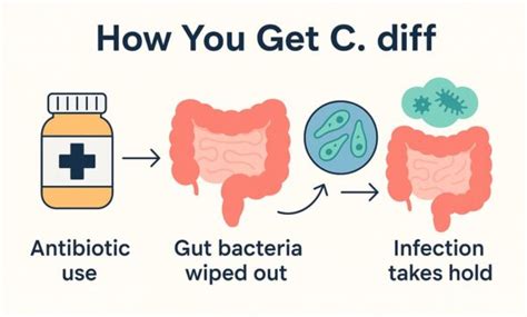 What Is C Diff And How Do You Get It Embrace Health