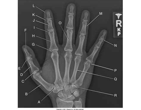 Elbow Fat Pads Labeling X Ray Quiz