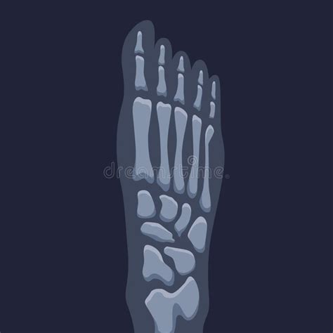 Human Bones Orthopedic And Skeleton Icon Bone X Ray Image Of Human