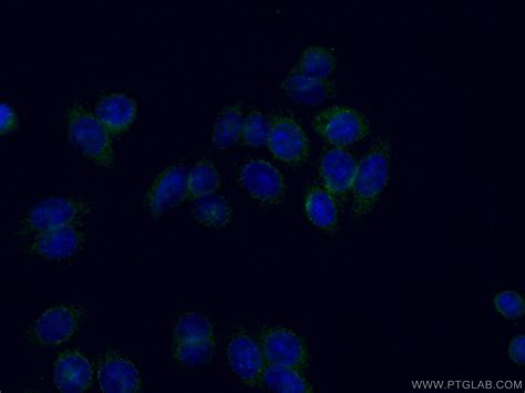 Pck1 Antibody 66862 1 Ig Proteintech