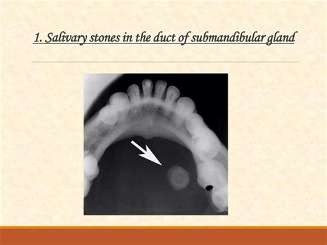 Occlusal Radiography Pptx Dental Health Diseases And Conditions