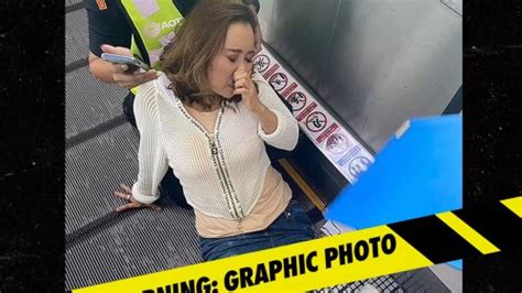Woman Loses Leg After Getting It Caught In An Airport Travelator Graphic Photos Flipboard