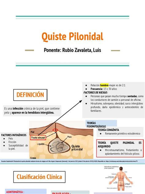Quiste Pilonidal Pdf